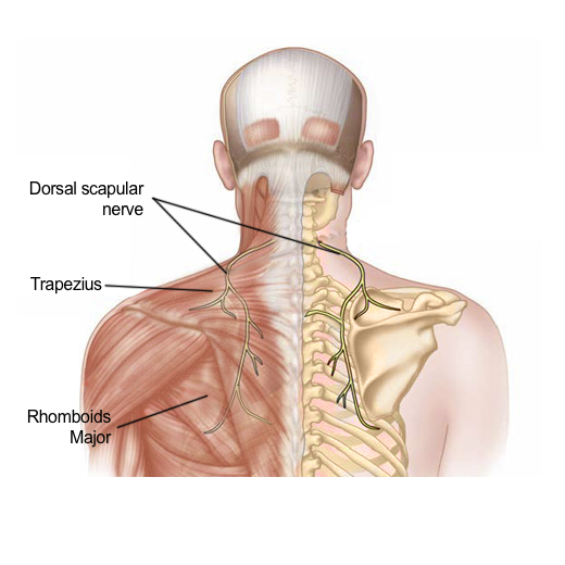 Dorsal Scapular Nerve Entrapment Syndrome Pain Spa